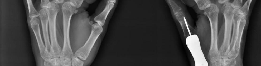 Meticuly - Jobs, Reviews, Photos | WorkVenture